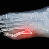 Lets Hit The Ice. - Stomp On Yo Toews..... | Fantasy Hockey | Yahoo! Sports